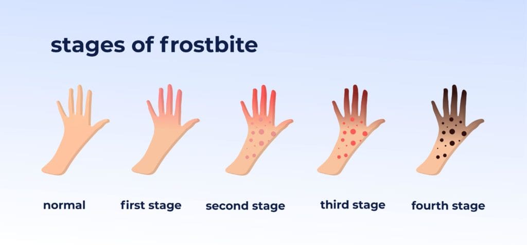 How to Safely Change a Forklift Propane Tank [Step-by Step Guide]